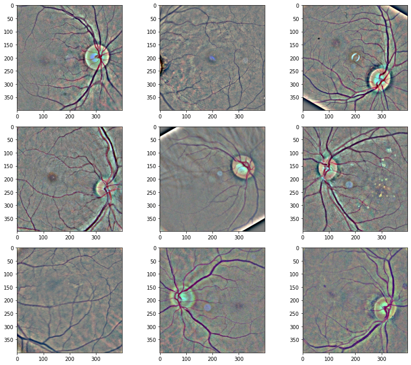GitHub - NadavGB86/Diabetic_Retinopathy_Detection
