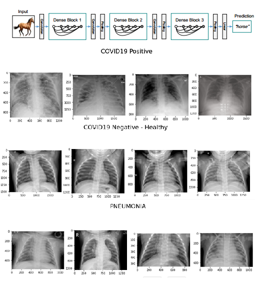 Convoluationalneuronnetonchestx Raydata3007project2ipynb At Master · Light100bc 