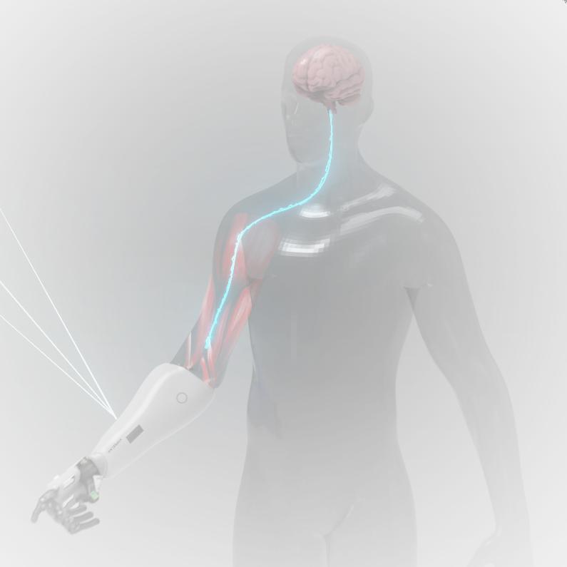 GitHub - IBishopI/versi_Bionics: Project aimed to help people who lost hand(s)