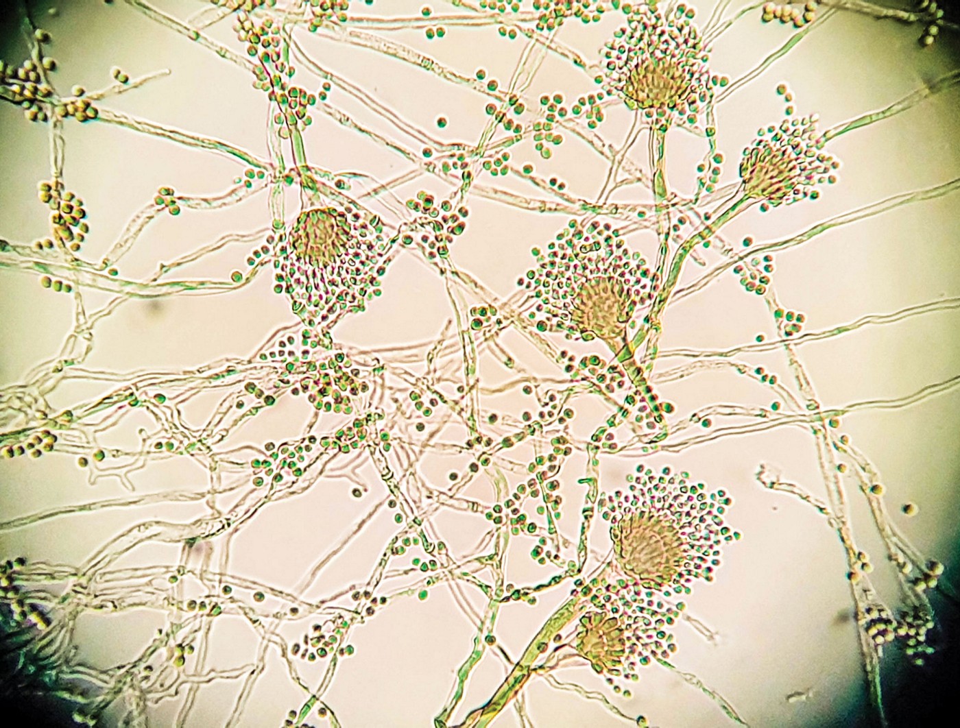 GitHub - jess789550/Project1B: Identification of Potential ...