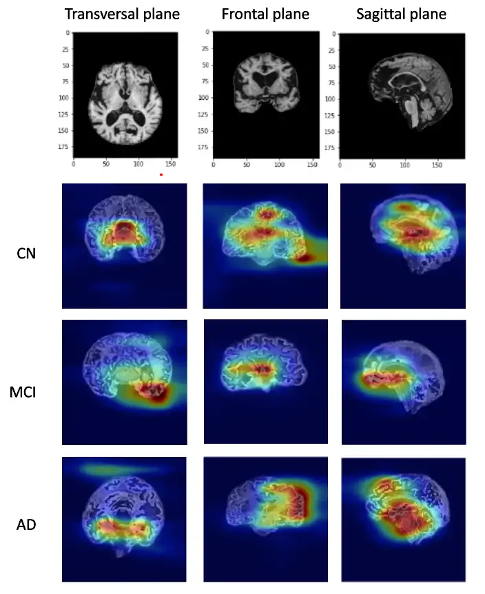 GitHub - BrunoKreiner/brain-health-challenge: Project "Understanding Brain Health, EDA & DL with ...