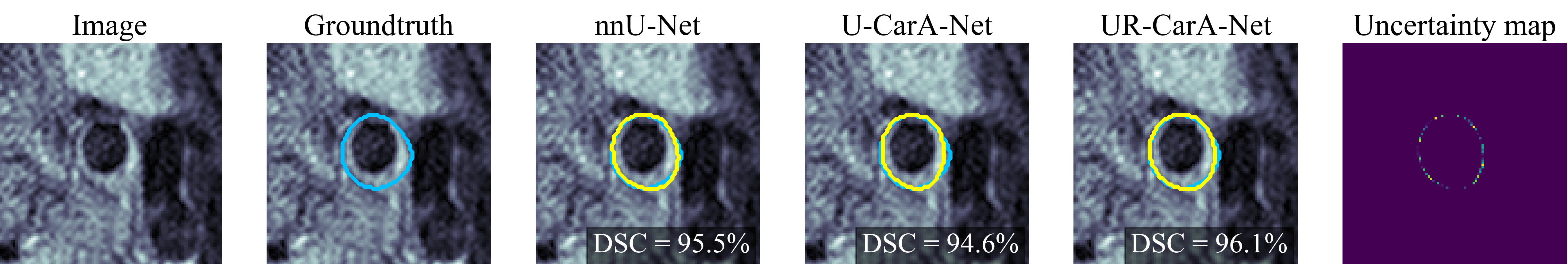 uncertainty-regularization · GitHub Topics · GitHub