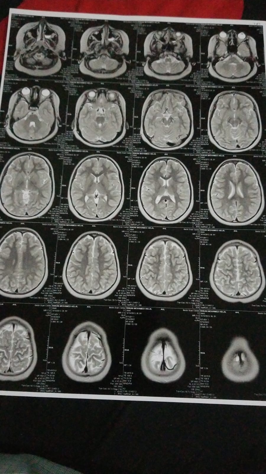 GitHub - Burakan77/furry-octo-telegram