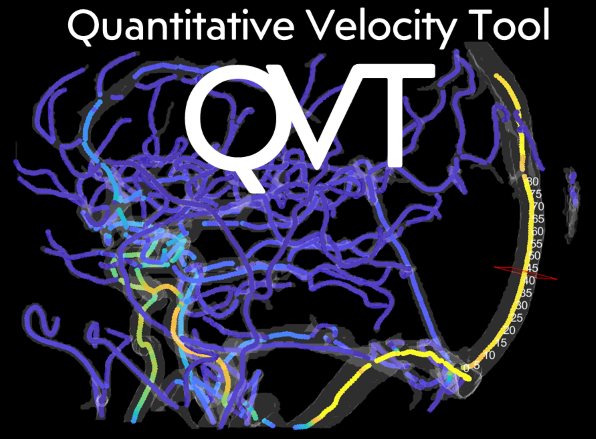 GitHub - uwmri/QVT: Cranial 4D Flow Analysis Tool