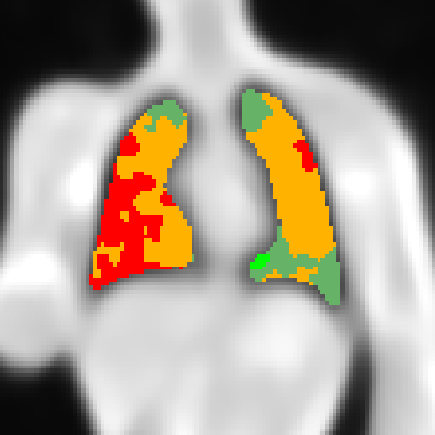 GitHub - joeyplum/age-dependence-gamlss: A repository that contains instructions and code ...