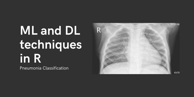 ML_-and-DL--Diagnosis_of_pneumonia_given_Xray_images/pneumonia_Xray.html at main · saranme/ML ...