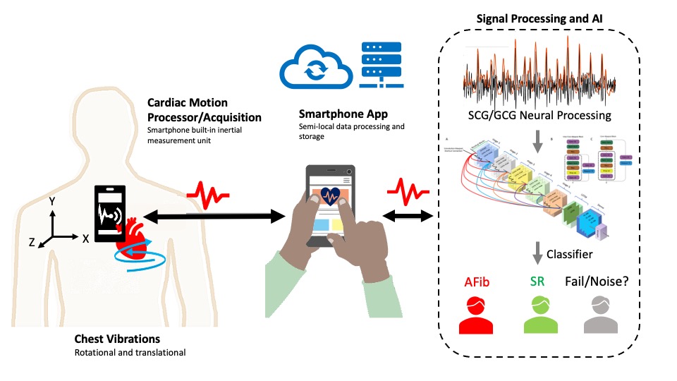 Github Mojjaf Smartphone Atrial Fibrillation Detection This Is A