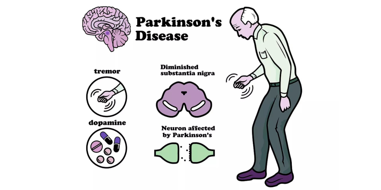 GitHub - Mudit-Sharma-30/PARKINSON-DISEASE-CLASSIFICATION-USING-MACHINE-LEARNING-TECHNIQUES