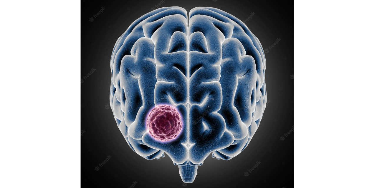 Github Piyush0364 Cancer Detection Using Deep Learning This Is A Deep Learning Which Is Used