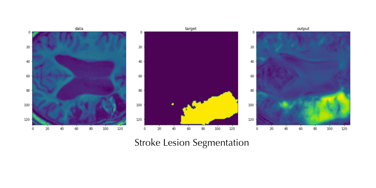 Github Oscar Mo Stroke Lesion Segmentation