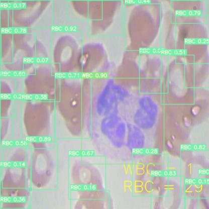 GitHub - AqsaRasheed/Complete-Blood-Count-CBC-: Complete Blood Cells Detection and Counting