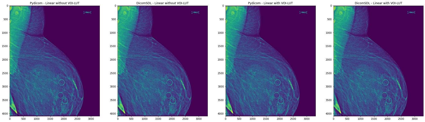 GitHub - AsifIkbal1/-DicomSDL-RSNA-Screening-Mammography-Breast-Cancer-Detection: DicomSDL, RSNA ...
