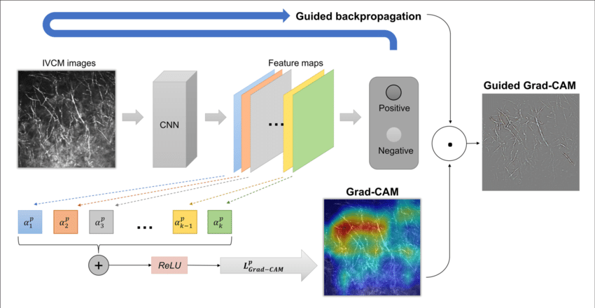 GitHub - AsifIkbal1/RSNA-EfficientNetV2-Training-Tensorflow-TPU: RSNA ...