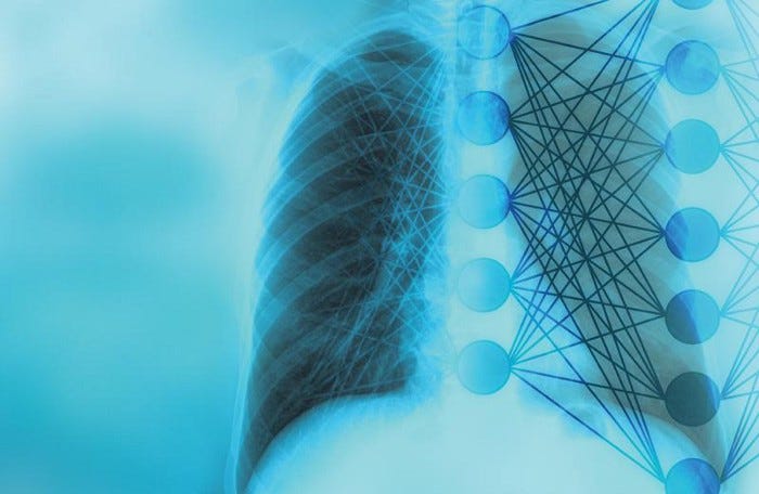 Github Msikorski93 Pneumonia Recognition With Deep Learning And Tensorflow A Binary