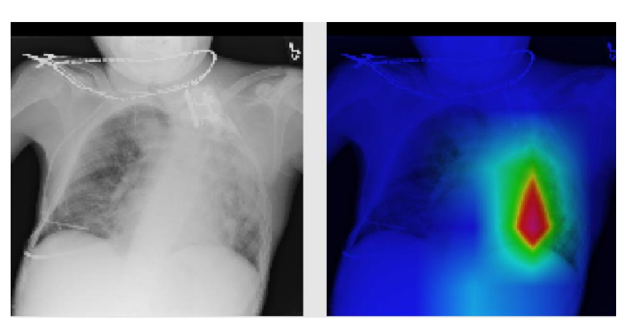 GitHub - HC0416/COVID-19-Pneumonia-Detection-Web-Based-Managent-System