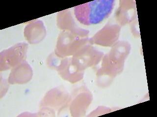 GitHub - kuldeepkrjha/blood-cell-detection: this is a blood cell ...