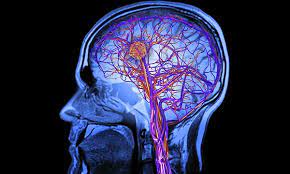 GitHub - Chuka-J/Brain_Stroke_Analysis: Analysis of the Brain stroke public dataset from kaggle ...