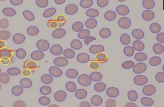 GitHub - NamkhangNLe/Cancer-Cell-Classification: Program for identifying, tallying, and ...