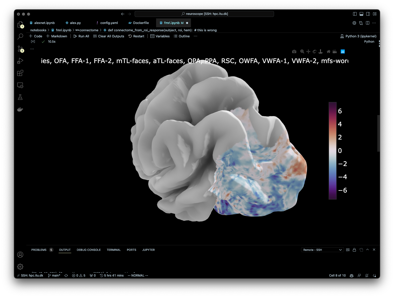 GitHub - syrkis/neuroscope: lock picking your skull