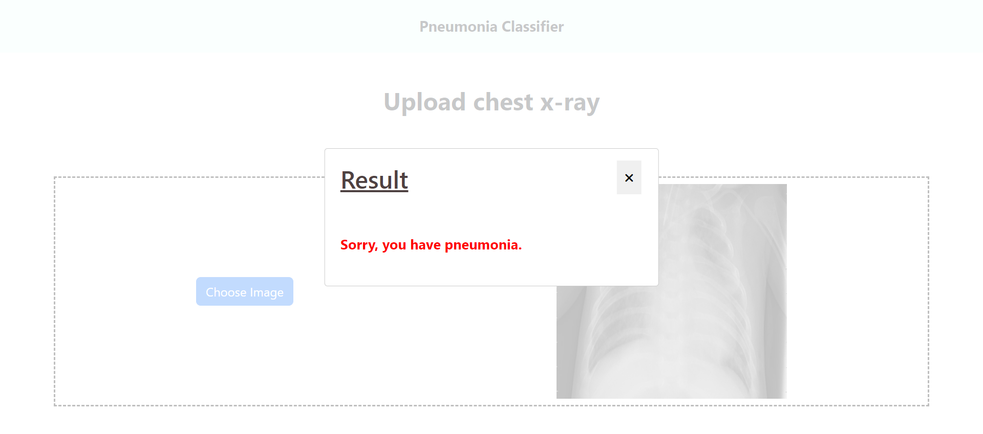 GitHub - techrajat/pneumonia-classifier: ML model to classify whether a person has Pneumonia or not.