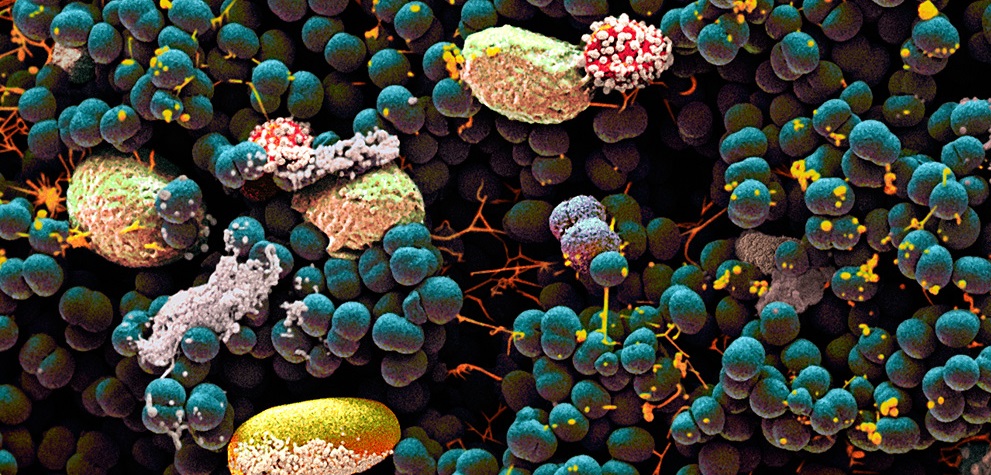 GitHub - jepowers65/belly-button-challenge