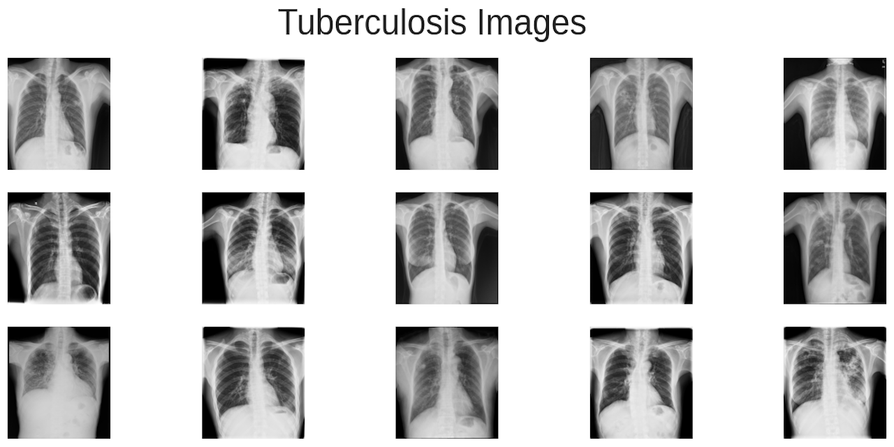 tuberculosis-classification · GitHub Topics · GitHub tuberculosis-classification · GitHub Topics · GitHub