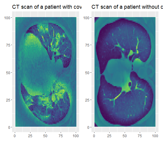 GitHub - Alex-Stavrop/covid-scans-classification