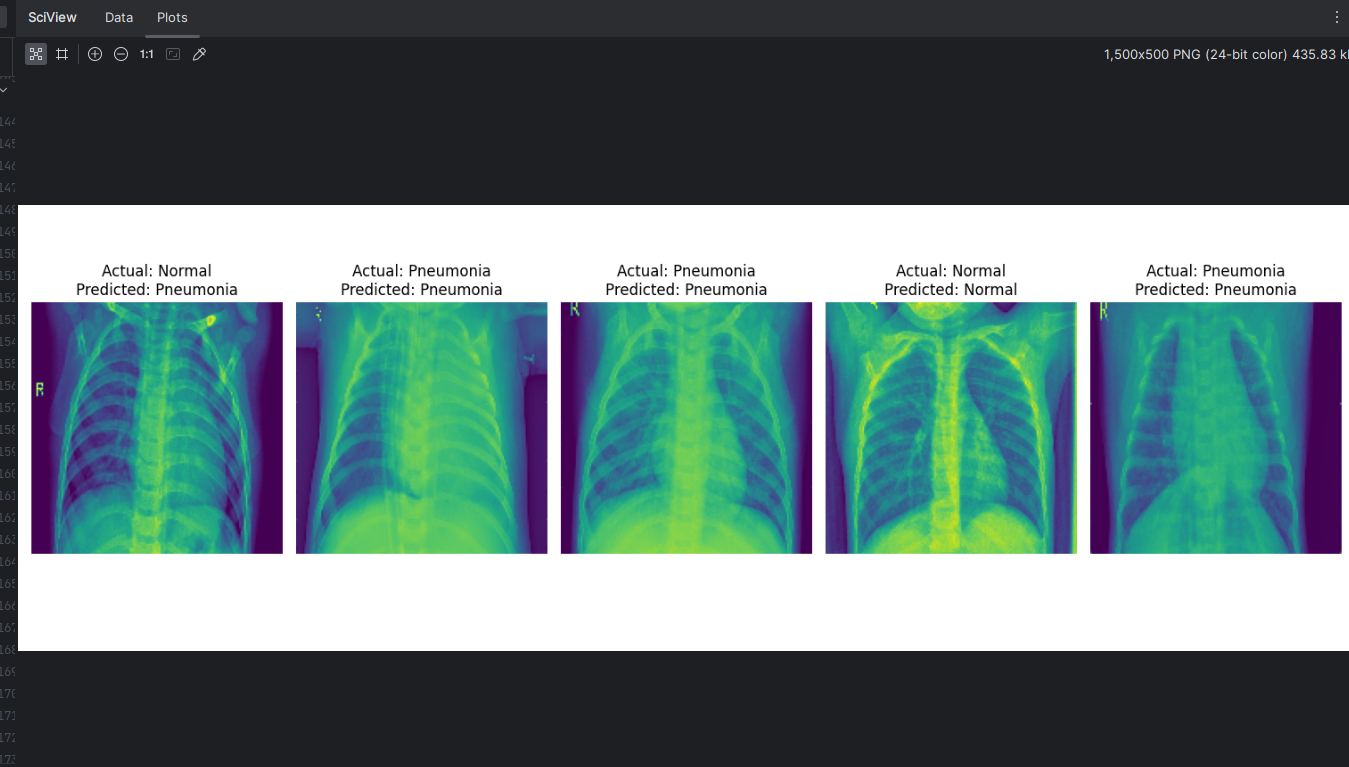 GitHub - RahmatzadaAbdulGhafor/MachineLearningPneumonia: Training a ...