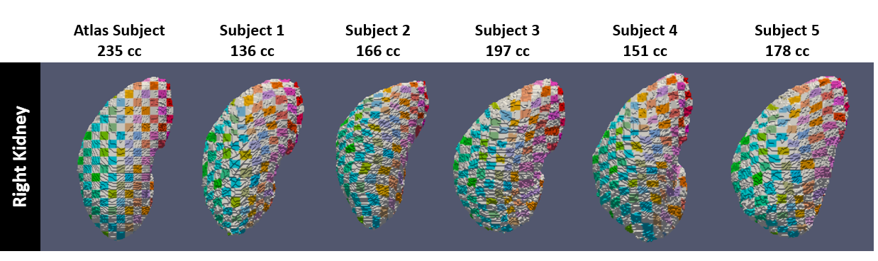 GitHub - MASILab/atlas_surface_rendering: Generate a surface to show ...