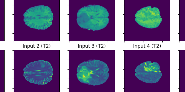 mri-brain · GitHub Topics · GitHub