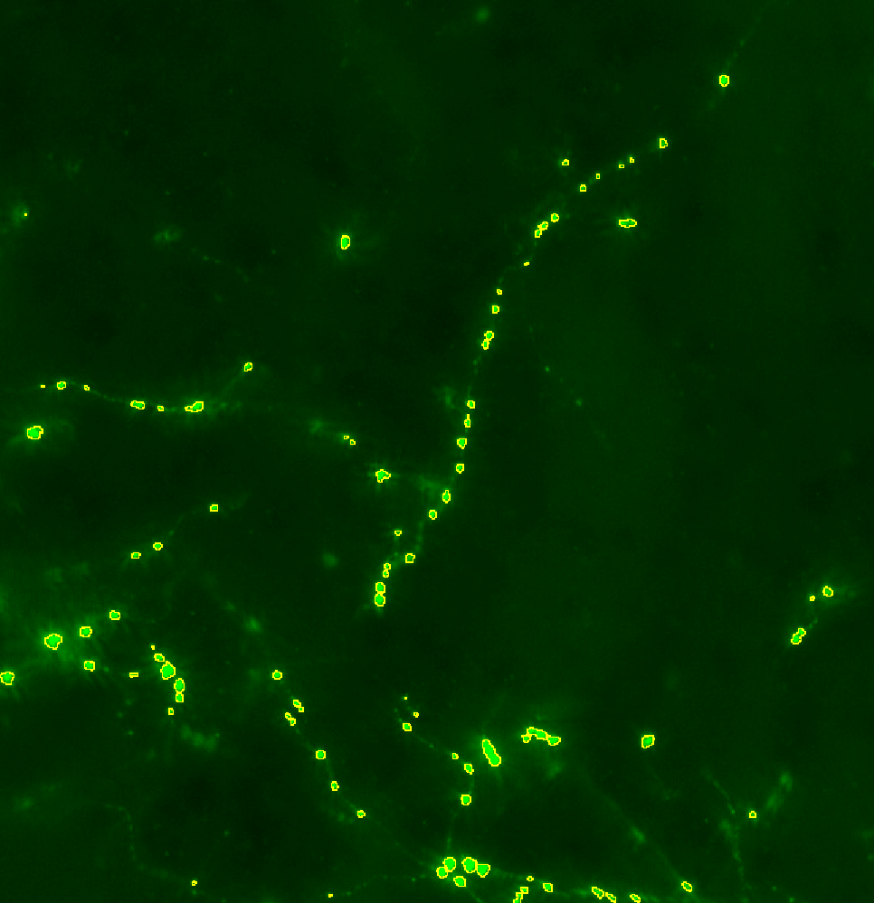 GitHub - seh2232/ImageJ_Nuclei_Bouton_Counter_Batch: ImageJ Macro to ...