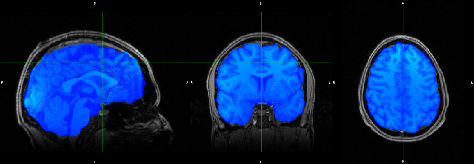 GitHub - elinepppc/Neuroscience: A collection of the neuroscience papers I have written so far