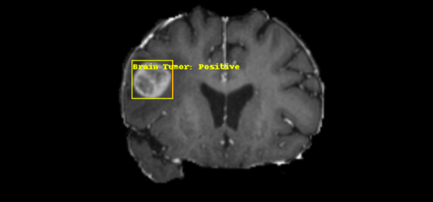 Github Tandez Computer Vision