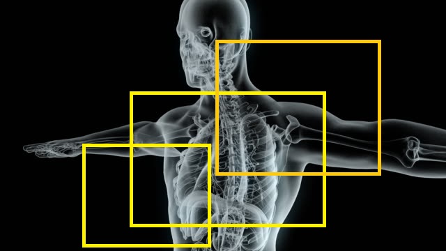 Pneumonia Tuberculosis Classification Using X Ray Images Xray Respiratory Diagnosis Ipynb At
