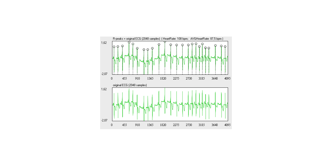 Github Veftodii Ecg Dsp Fd Informational System For Ecg Digital