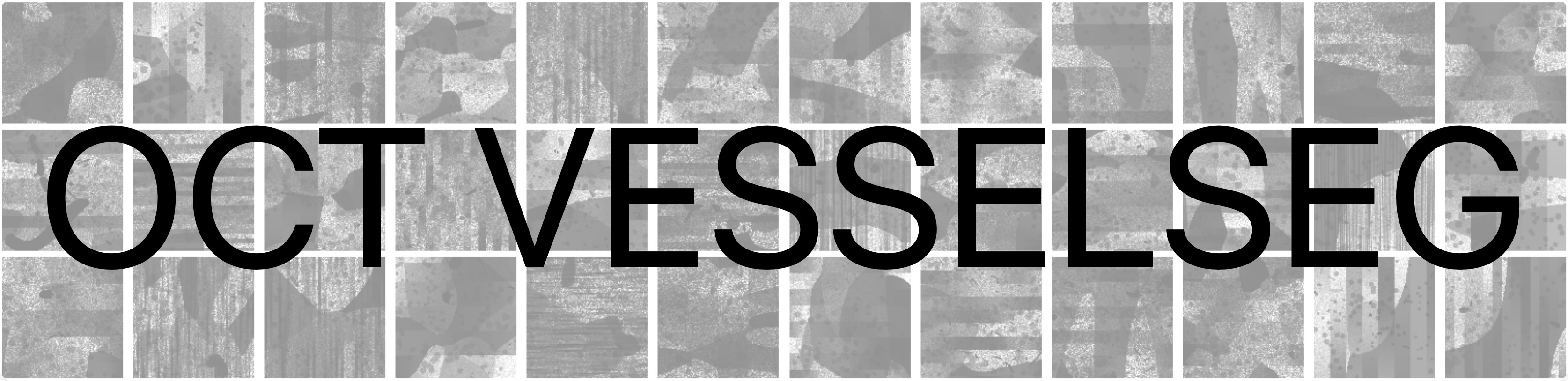 Github Etiennecholletoctvesselseg A Label Free And Data Free Synthesis Engine And Training 