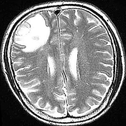 GitHub - vedang-patil-23/Brain-MRI-Classification: This project ...