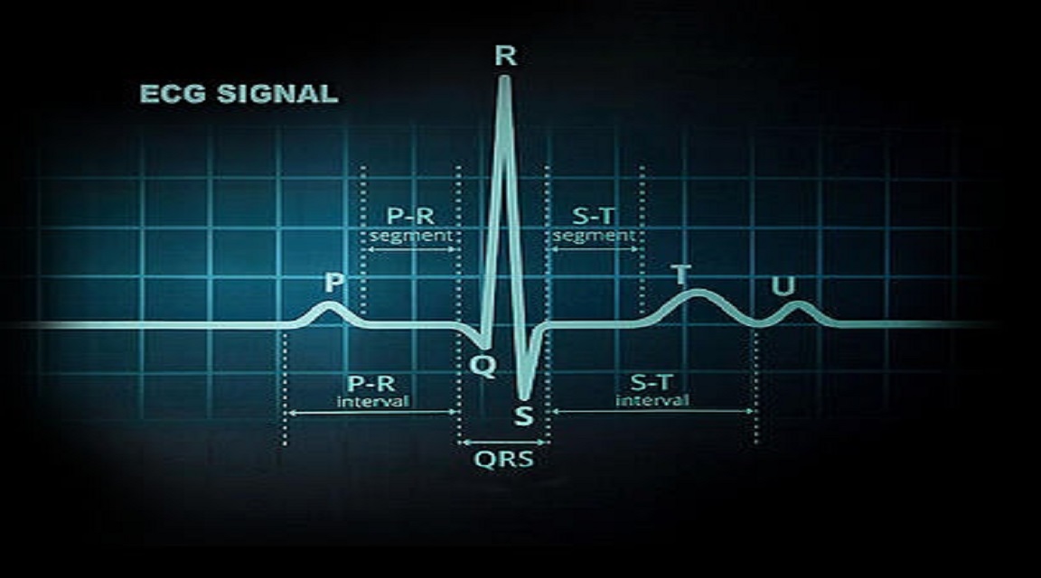 GitHub - MatinRafiei/ecgClustering: Separate the QRS signal of Fetal and Maternal!