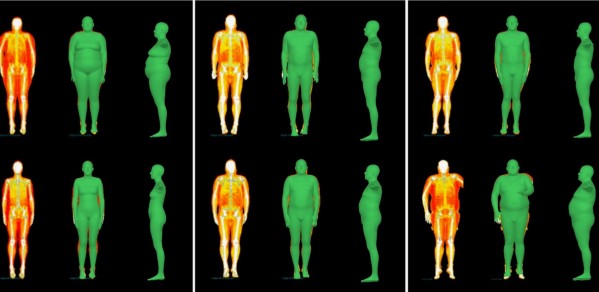 GitHub - Chanu002/Body-Fat-Predictive-Model-for-Medical-Diagnosis
